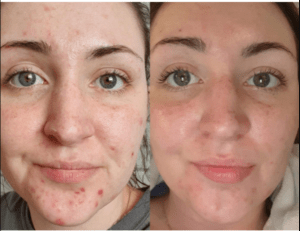 Is Your Skin Sensitive? Identify the Different Symptoms - Dr Beauty