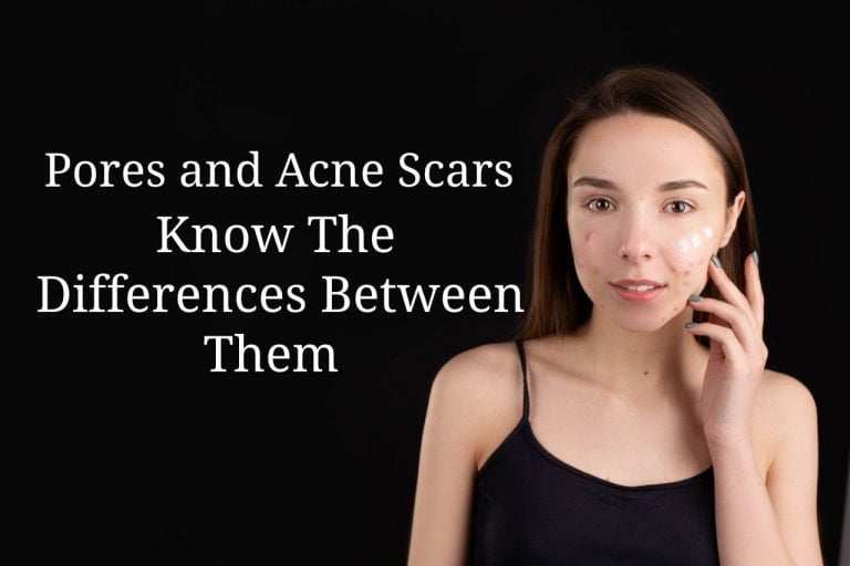 Pores and Acne Scars - Causes and Treatment